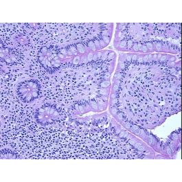 Frozen Tissue Sections, Small intestine, CS615536 | Amsbio